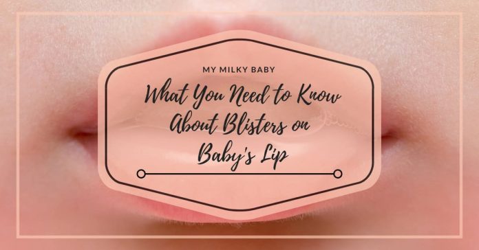 Everything You Need to Know About Blister on Baby Bottom Lip